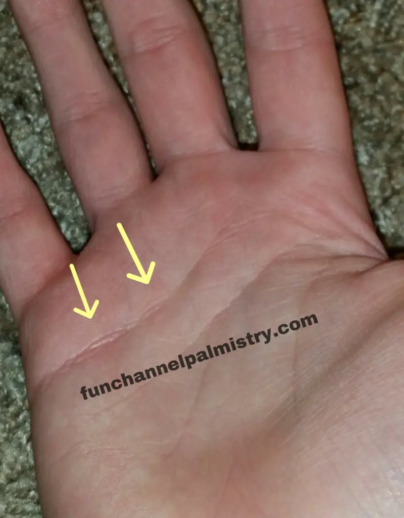 Palm Analysis Of A Stressed Person At A Young Age-Palmistry