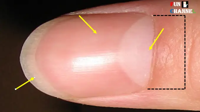 Do You Have Half Moon Shape On Your Nails?-Palmistry